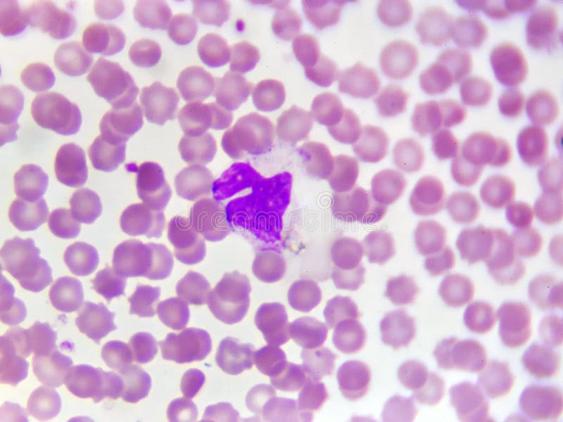 Monocyte cell stock photo. Image of lymphocyte, eosinophil - 99427000