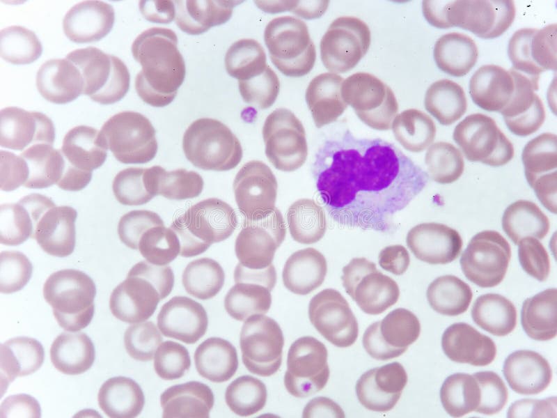 957 Monocyte Stock Photos - Free & Royalty-Free Stock Photos from ...