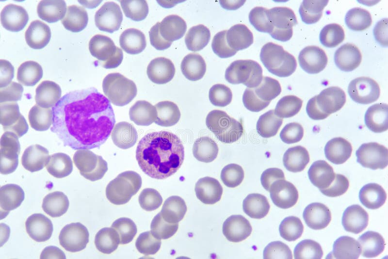 Monocyte En Neutrophil Cel in Bloedvlek Stock Foto - Image of ...