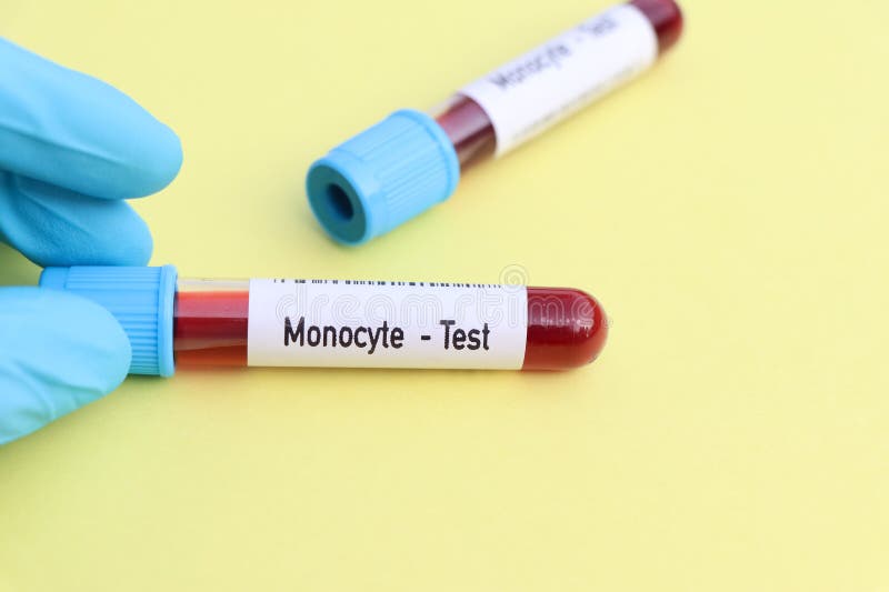 Monocyte Test, Blood Sample To Analyze in the Laboratory Stock Image ...