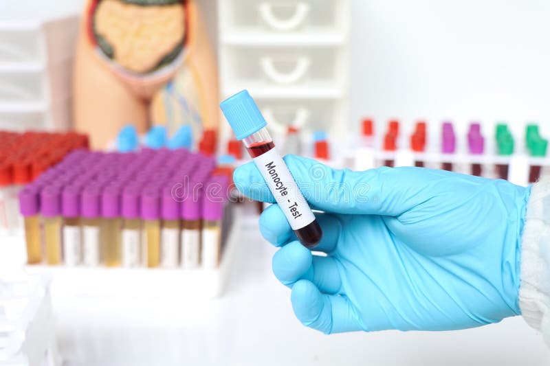 Monocyte Test, Blood Sample To Analyze in the Laboratory Stock Image ...