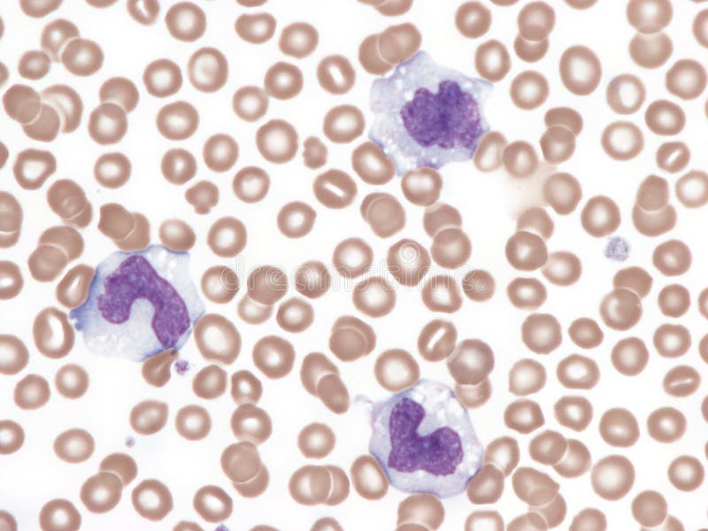 Monocytes In Peripheral Blood. Wright X1000. Picture Image: 373679067