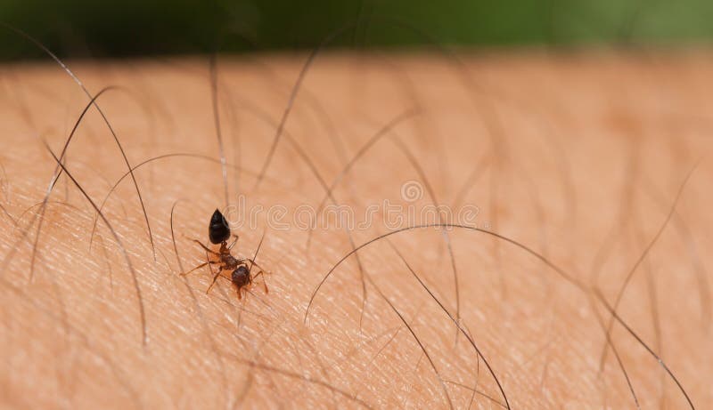 Attaque De Fourmi Par L'acide Citrique De Morsure Et De Jet Image stock ...
