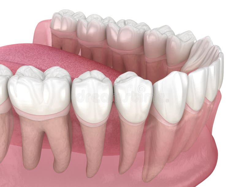 Morphology of Human Teeth. Medically Accurate Tooth 3D Illustration ...