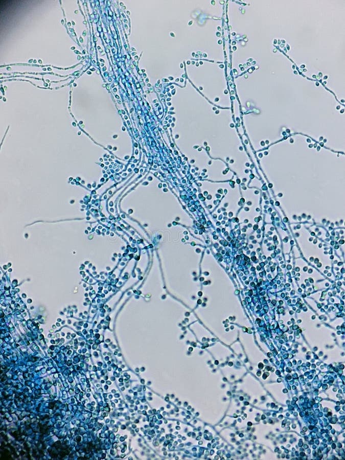 The Morphology of Sporothrix Schenkii Stock Photo - Image of schenkii ...