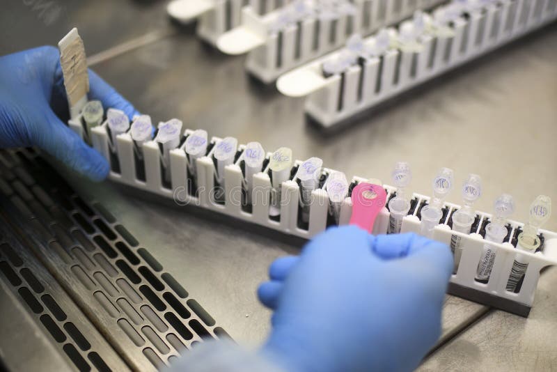 Test Tubes in the Laboratory in Which PCR Tests are Done for the ...