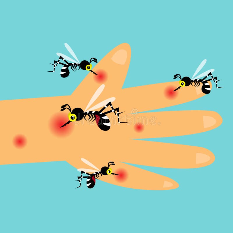 Mosquito bite hand stock vector. Illustration of mosquito - 185280608