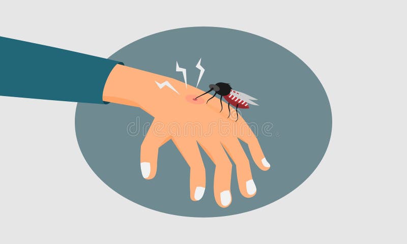 A Mosquito Bites Human Hand Dengue Fever Or Malaria Outbreak Concept Stock Vector