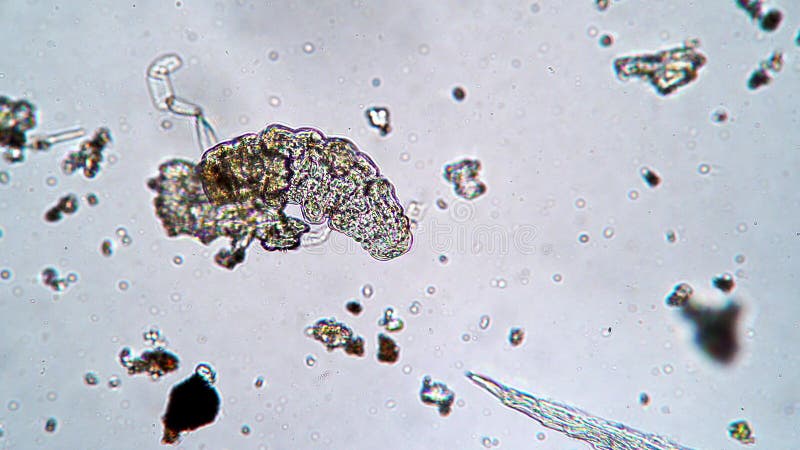 Exploring Microscopic Organisms in a Freshwater Sample Under a ...