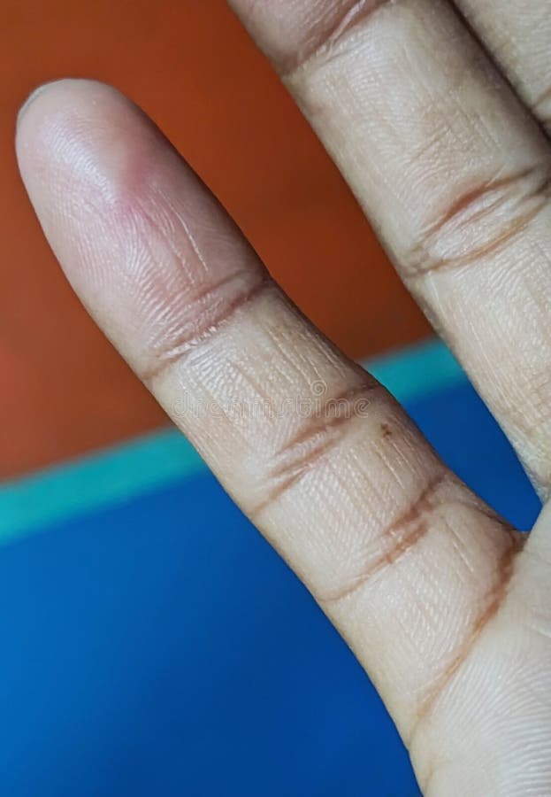 The Most Unique Little Finger in the World Has 4 Lines Stock Photo ...