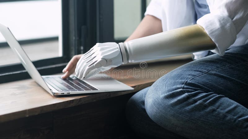 Motivated Woman Using Prosthetic Arm Working or Learning Notebook ...