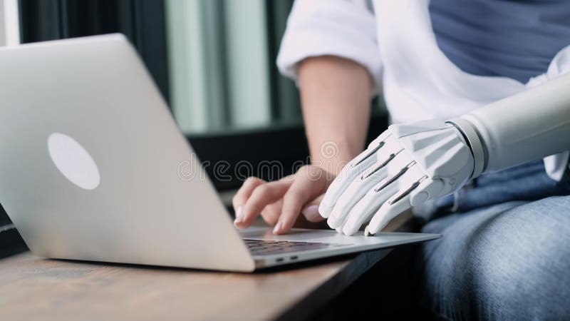 Motivated Woman Using Prosthetic Arm Working or Learning Notebook ...