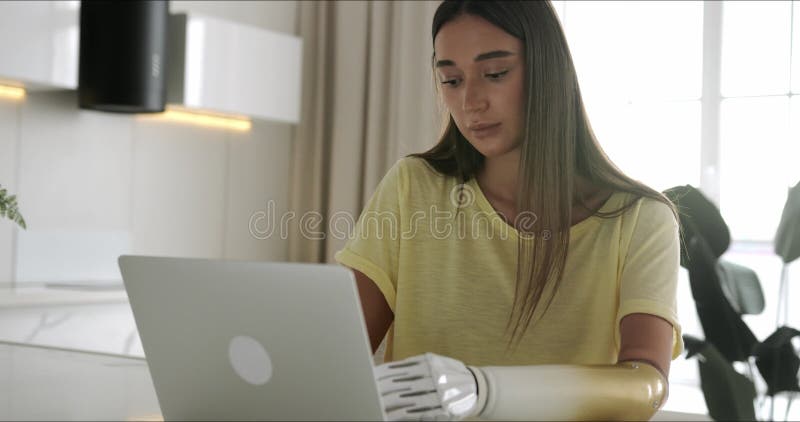 Motivated Woman Using Prosthetic Arm Working or Learning Notebook ...