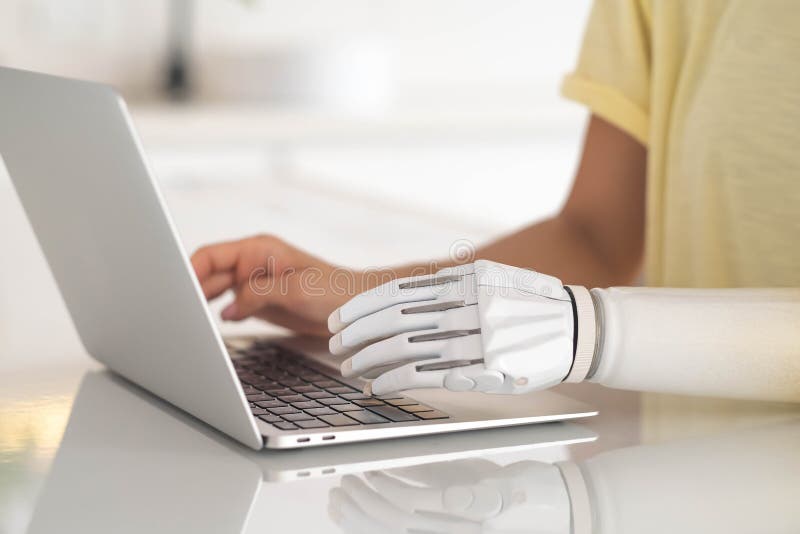 Motivated Woman Using Prosthetic Arm Working or Learning Notebook ...