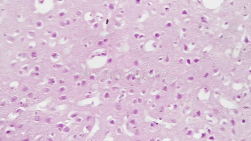 Motor Cortex Section of Human Being Magnified Under Microscope 40 on ...