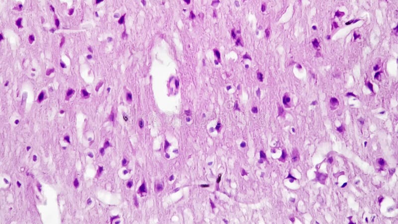 The Motor Cortex Section of a Human Being Brain is Magnified 400x Under ...