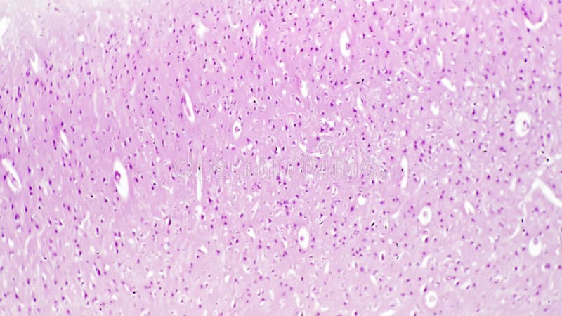 Section of Human Large Intestine Magnified Under Microscope 400x Filmed ...