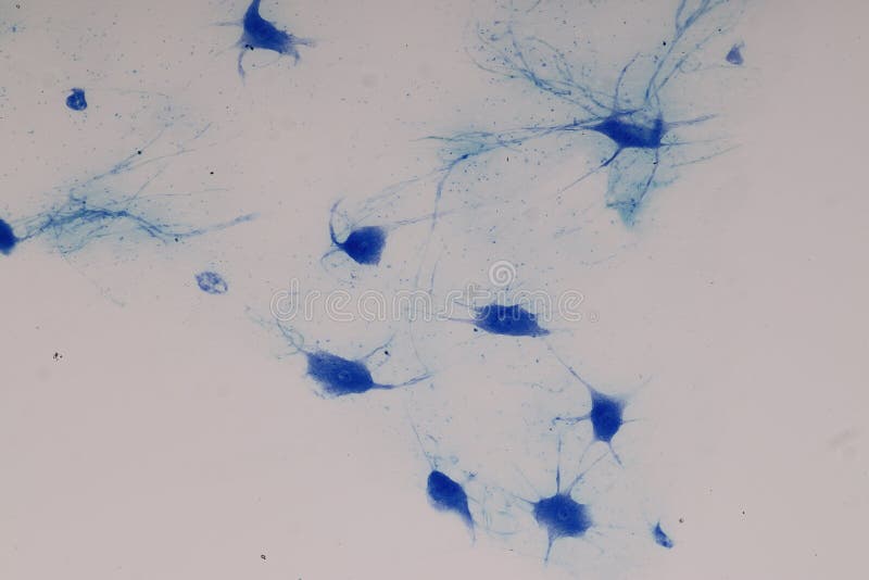 Motor Neuron and Nerve Cells Under the Microscope. Stock Image - Image ...