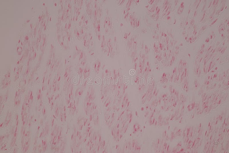 Motor Neuron and Nerve Cells Under the Microscope. Stock Photo - Image ...