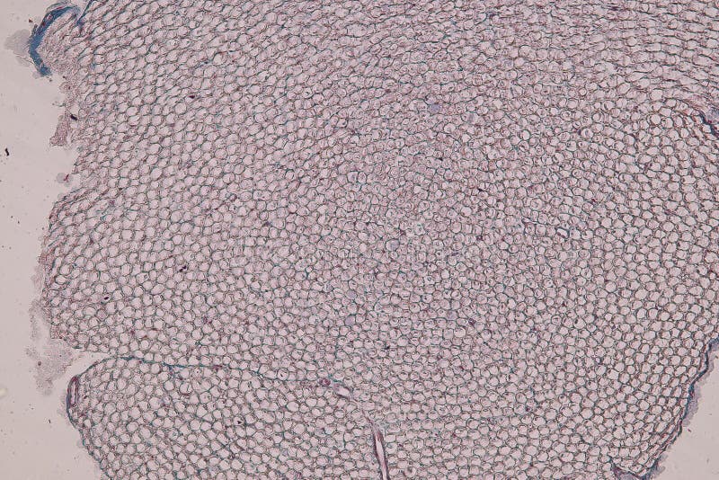 Motor Neuron and Nerve Cells Under the Microscope. Stock Photo - Image ...