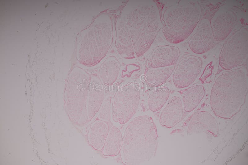 Motor Neuron and Nerve Cells Under the Microscope. Stock Photo - Image ...
