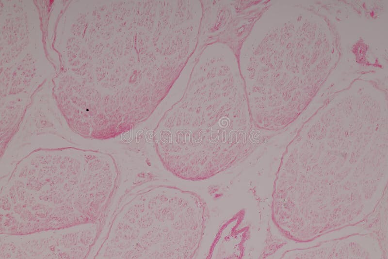 Motor Neuron and Nerve Cells Under the Microscope. Stock Image - Image ...