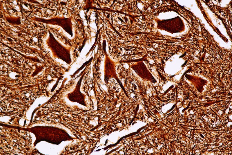 Motor Neuron and Nerve Cells Under the Microscope. Stock Photo - Image ...