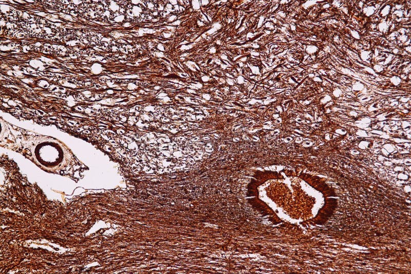 Motor Neuron and Nerve Cells Under the Microscope. Stock Image - Image ...