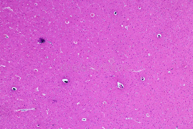 Motor Neuron and Nerve Cells Under the Microscope. Stock Photo - Image ...