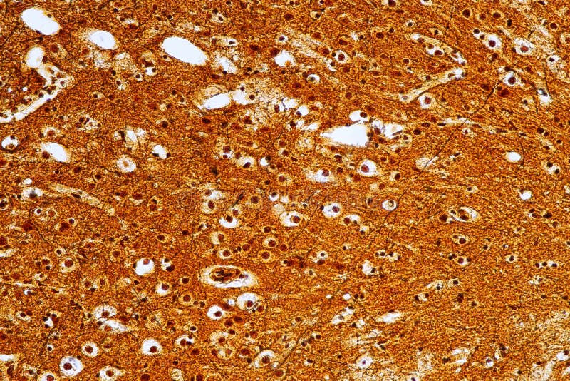 Motor Neuron and Nerve Cells Under the Microscope. Stock Photo - Image ...