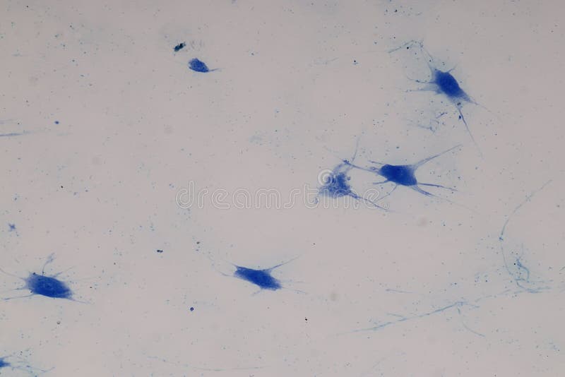 Motor Neuron and Nerve Cells Under the Microscope. Stock Image - Image ...