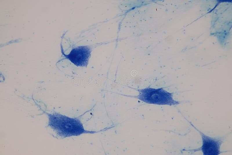 Motor Neuron and Nerve Cells Under the Microscope. Stock Photo - Image ...