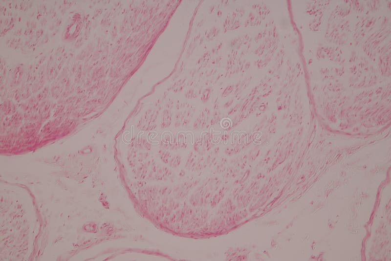 Motor Neuron and Nerve Cells Under the Microscope. Stock Image - Image ...