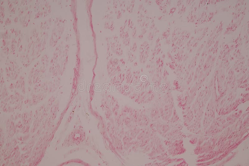 Motor Neuron and Nerve Cells Under the Microscope. Stock Image - Image ...