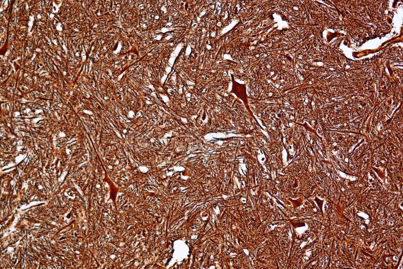 Motor Neuron and Nerve Cells Under the Microscope. Stock Photo - Image ...