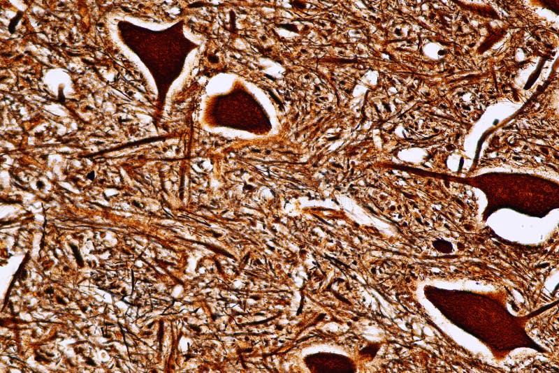 Motor Neuron and Nerve Cells Under the Microscope. Stock Image - Image ...