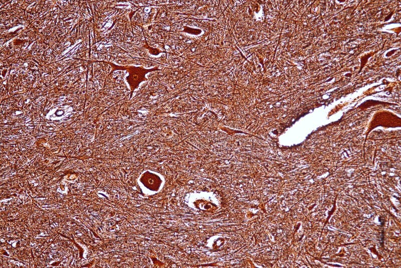 Motor Neuron and Nerve Cells Under the Microscope. Stock Photo - Image ...