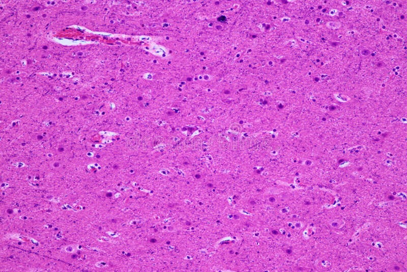 Motor Neuron and Nerve Cells Under the Microscope. Stock Photo - Image ...