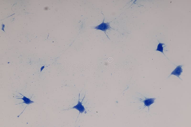 Motor Neuron and Nerve Cells Under the Microscope. Stock Photo - Image ...