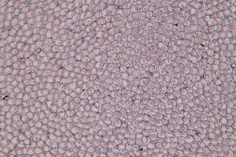 Motor Neuron and Nerve Cells Under the Microscope. Stock Image - Image ...