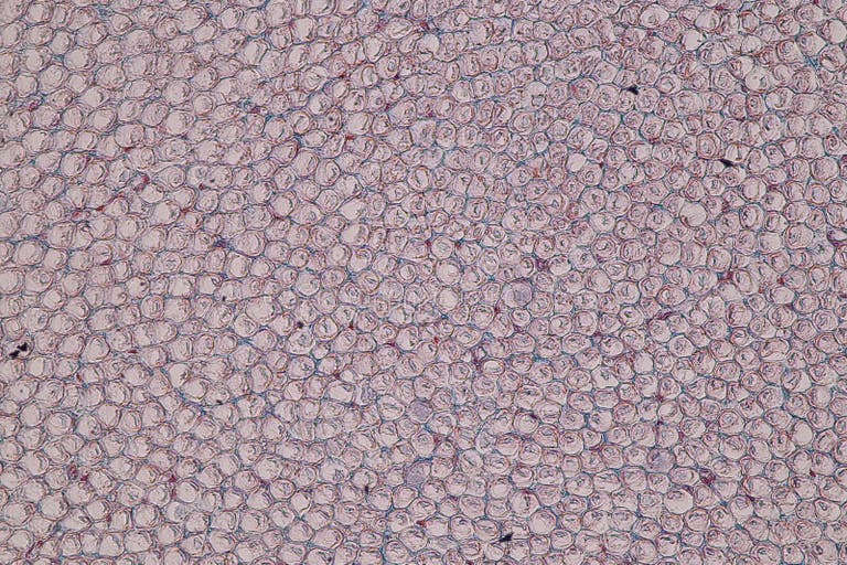 Motor Neuron and Nerve Cells Under the Microscope. Stock Image - Image ...