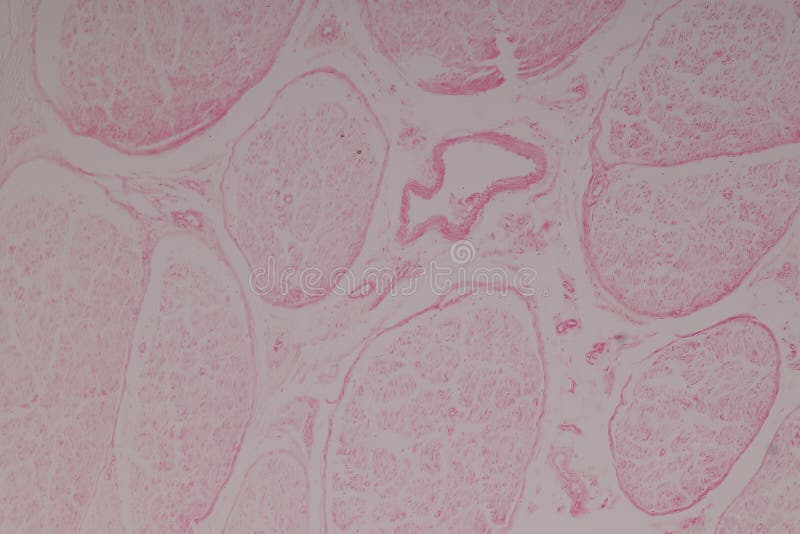 Motor Neuron and Nerve Cells Under the Microscope. Stock Photo - Image ...