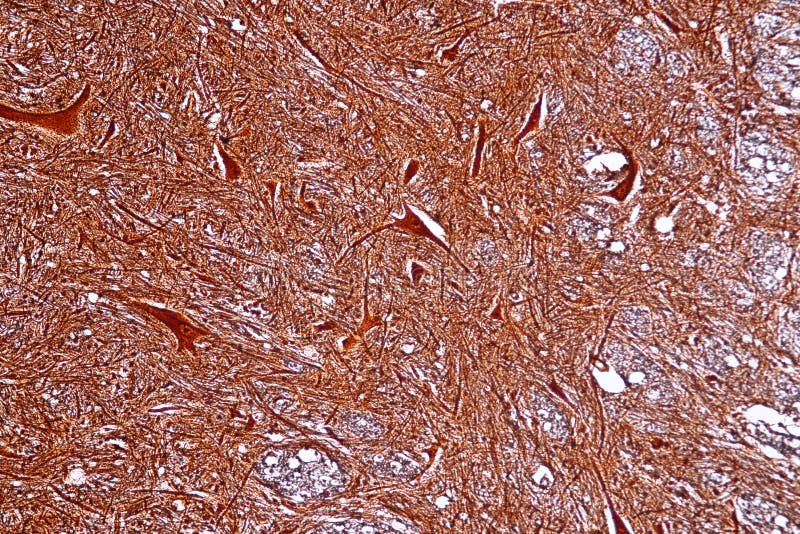 Motor Neuron and Nerve Cells Under the Microscope. Stock Image - Image ...