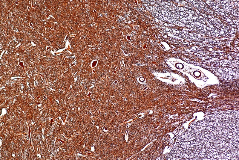 Motor Neuron and Nerve Cells Under the Microscope. Stock Image - Image ...