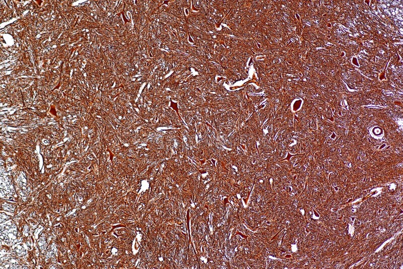 Motor Neuron and Nerve Cells Under the Microscope. Stock Image - Image ...