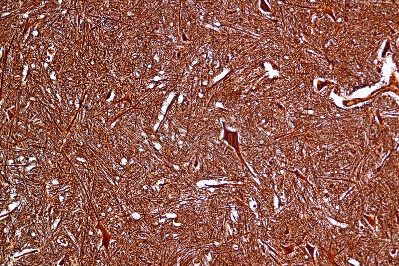 Motor Neuron and Nerve Cells Under the Microscope. Stock Photo - Image ...