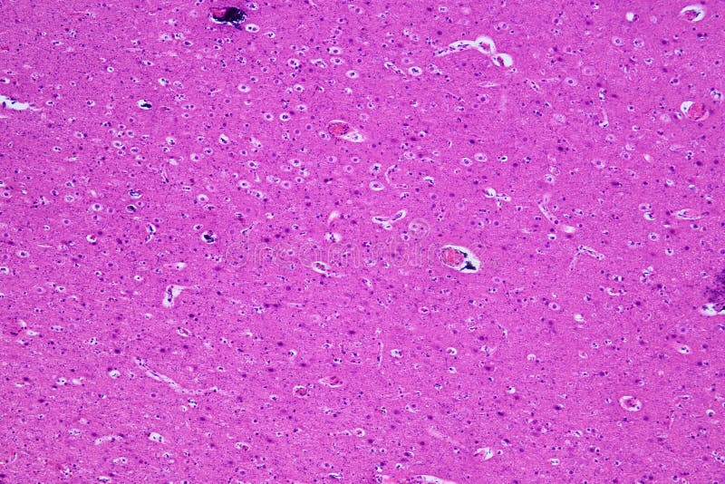 Motor Neuron and Nerve Cells Under the Microscope. Stock Image - Image ...