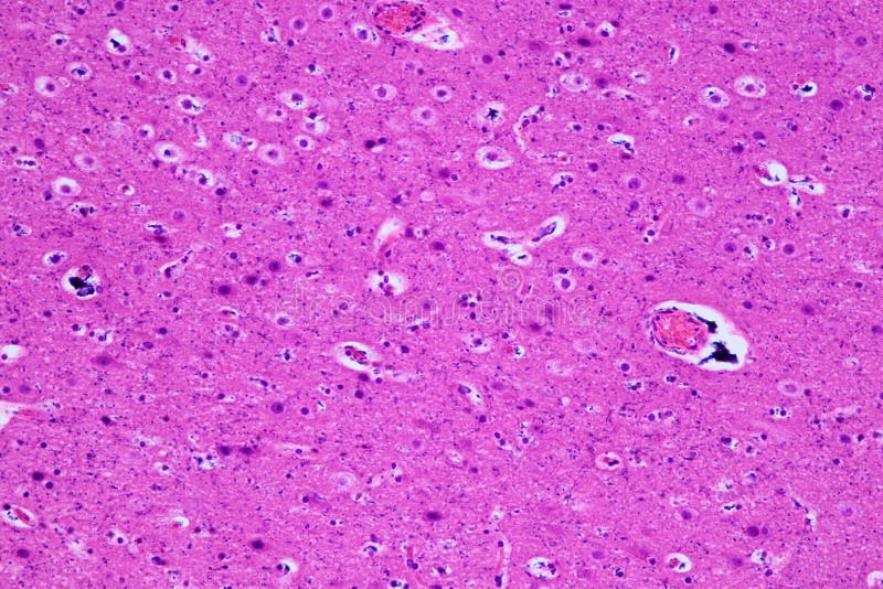 Motor Neuron and Nerve Cells Under the Microscope. Stock Image - Image ...