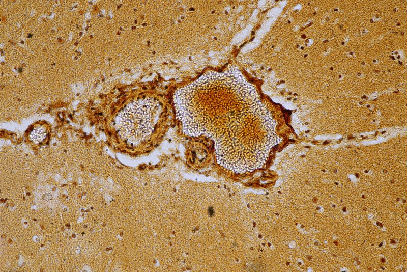 Motor Nerve Endings Under the Microscope Stock Image - Image of cell ...