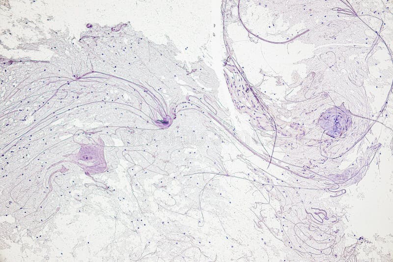 Motor Neuron, Spinal Cord, Nerve Fibres and Nerve Cells Under the ...